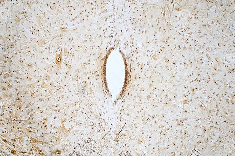 Cross Section of Spinal Cord Under the Microscope View Stock Photo ...