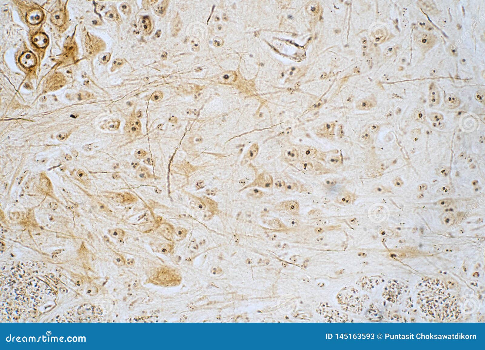 Cross Section of Spinal Cord Under the Microscope View Stock Image ...