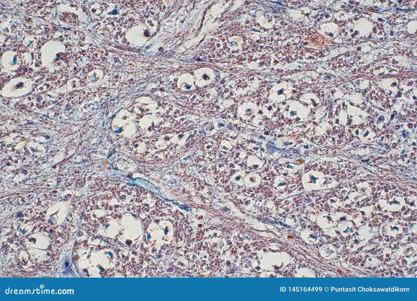 Cross Section of Spinal Cord Under the Microscope View Stock Image ...