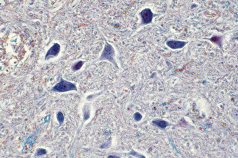 Cross Section of Spinal Cord Under the Microscope View Stock Image ...