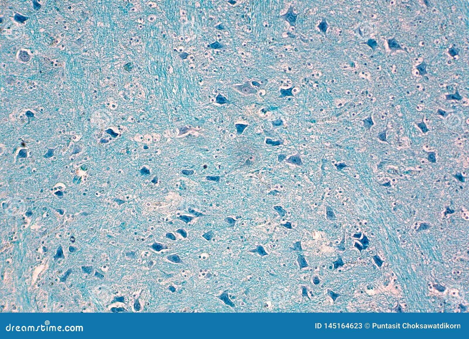 Cross Section of Spinal Cord Under the Microscope View Stock Image ...