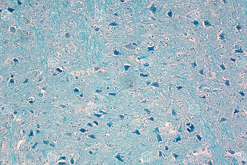 Cross Section of Spinal Cord Under the Microscope View Stock Image ...