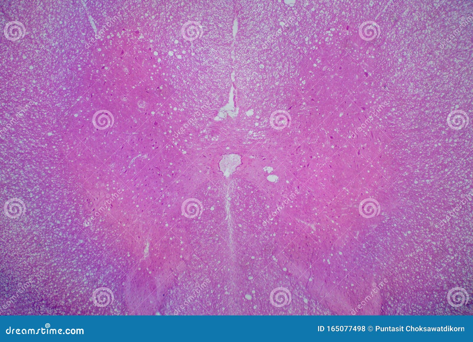 Cross Section of Spinal Cord Under the Microscope View Stock Photo ...