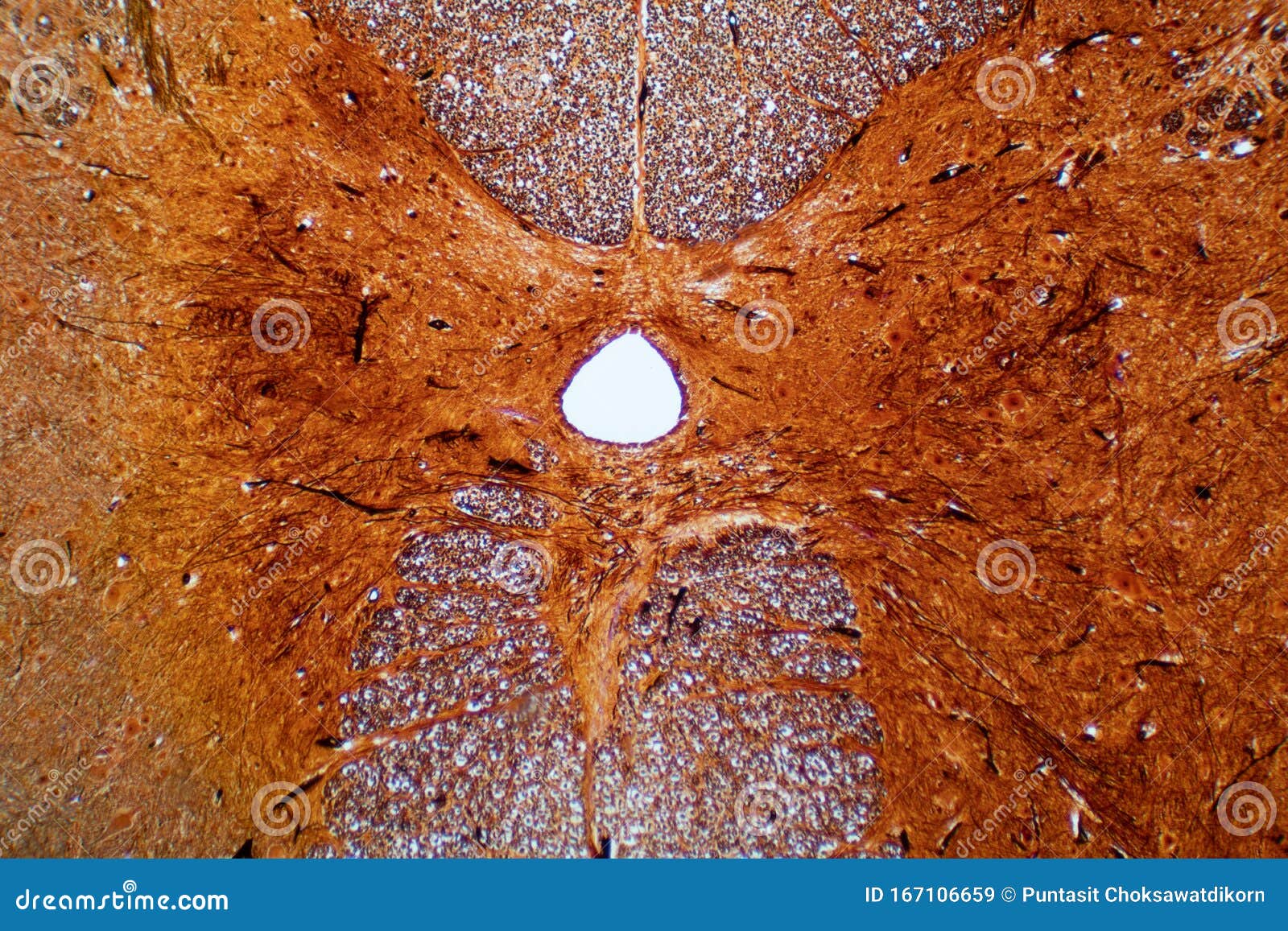Cross Section of Spinal Cord Under the Microscope View Stock Image ...