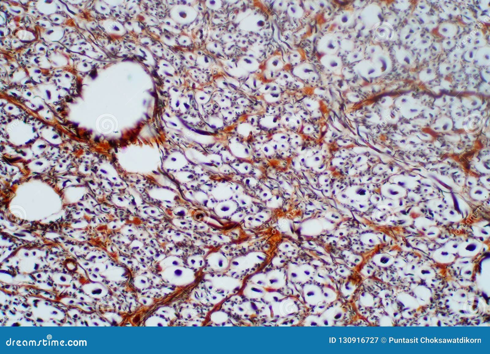 Cross Section of Spinal Cord Under the Microscope View. Stock Image ...