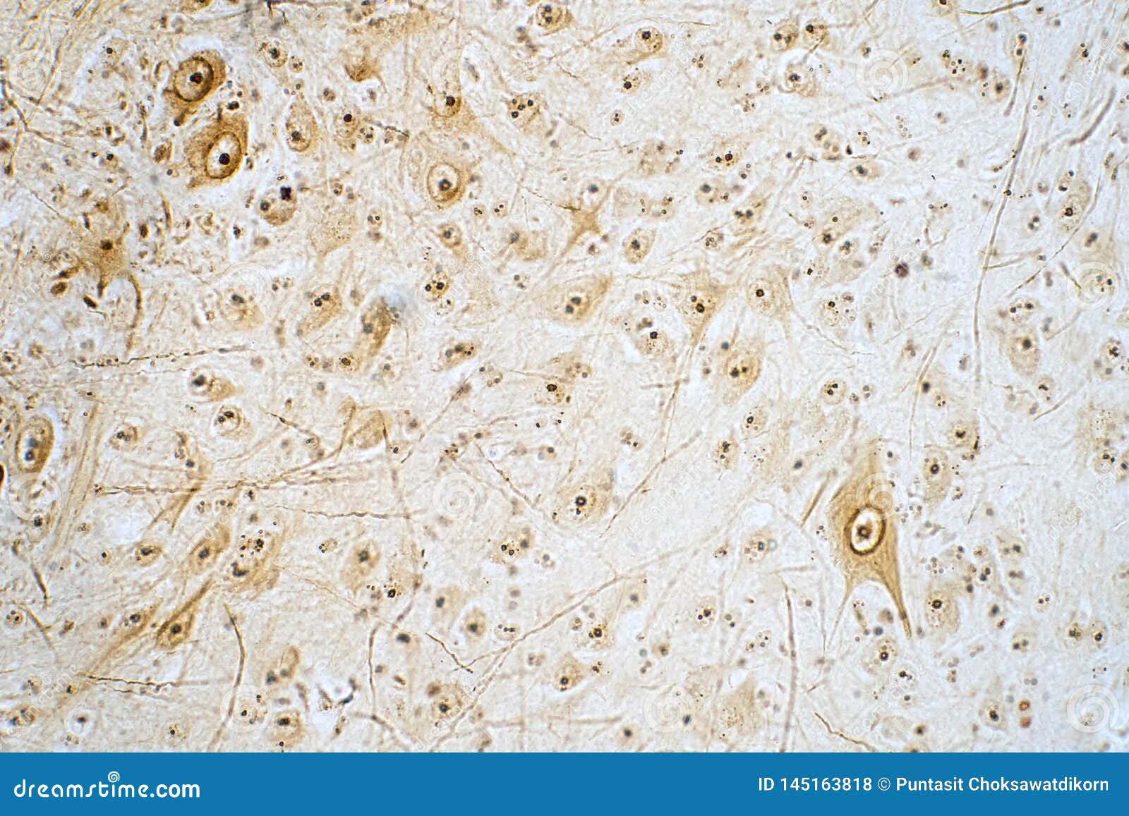 Cross Section of Spinal Cord Under the Microscope View Stock Photo ...