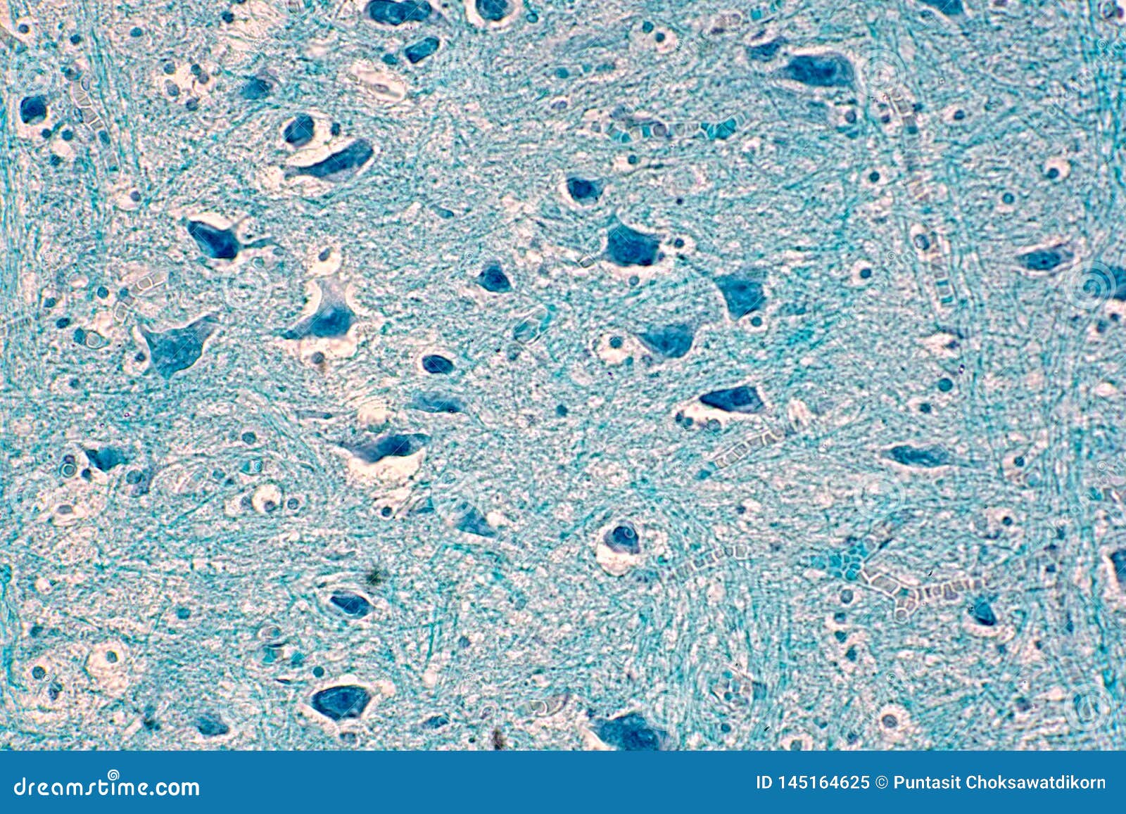 Cross Section of Spinal Cord Under the Microscope View Stock Image ... Cross Section of Spinal Cord Under the Microscope View Stock Image ...
