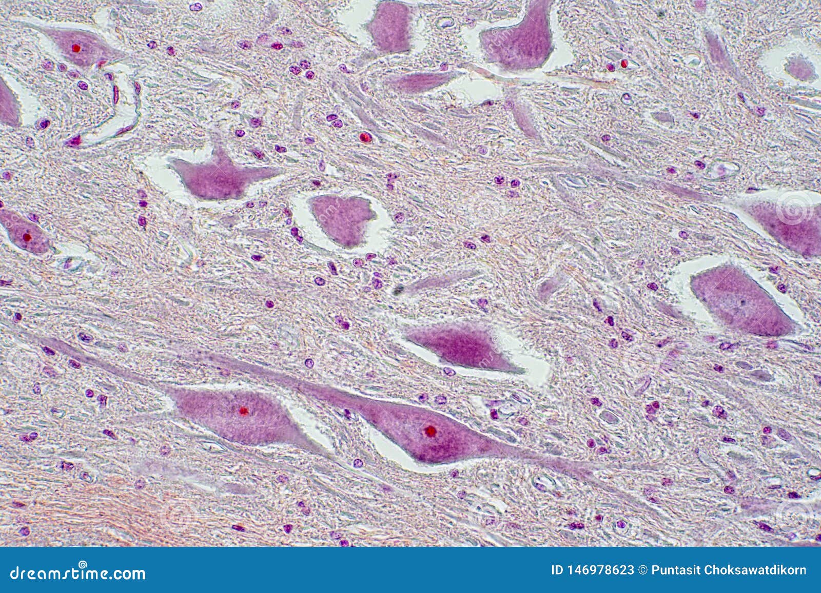 Cross Section of Spinal Cord Under the Microscope View Stock Image ... Cross Section of Spinal Cord Under the Microscope View Stock Image ...