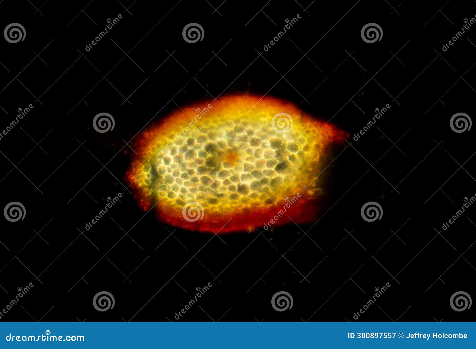 Cross Section of the Stem of a Moss, with Polarization Stock Image ...