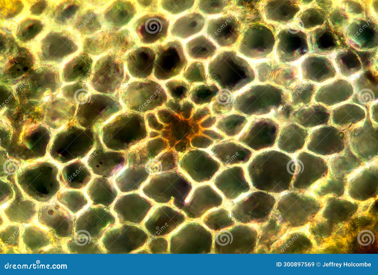 Cross Section of the Stem of a Moss, with Polarization Stock Image ...