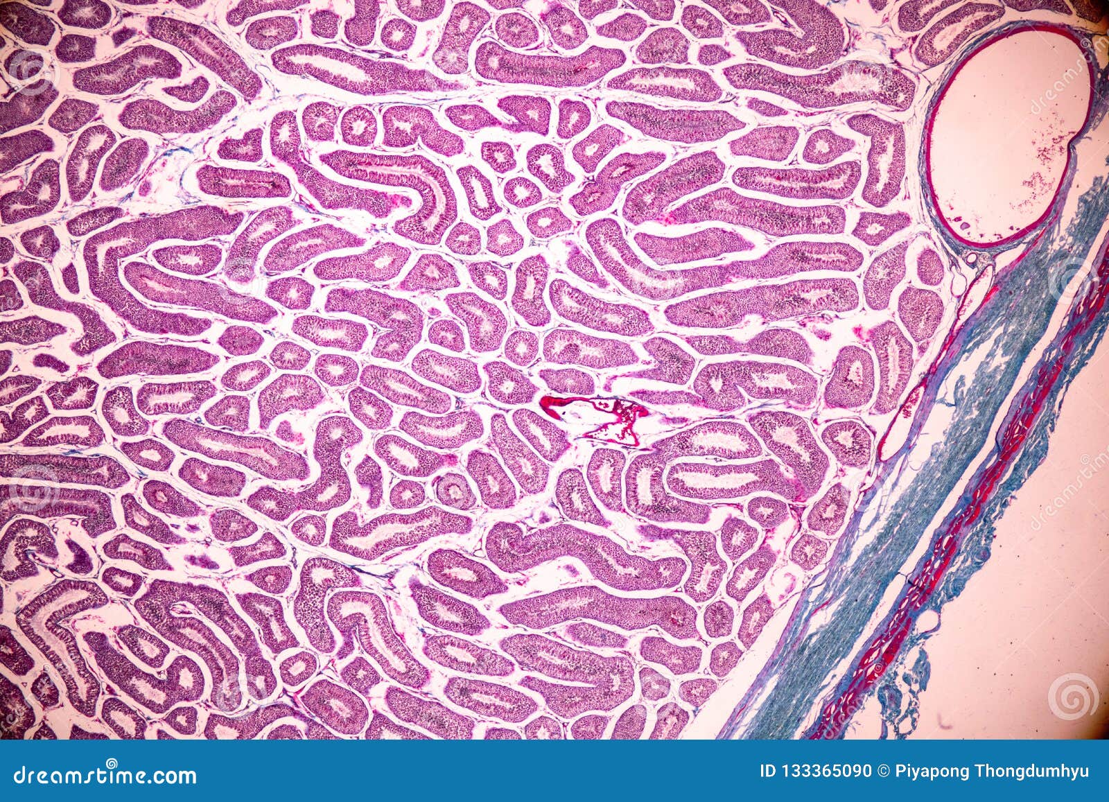 Section of Testis Tissue Under the Microscope . Stock Photo - Image of ...