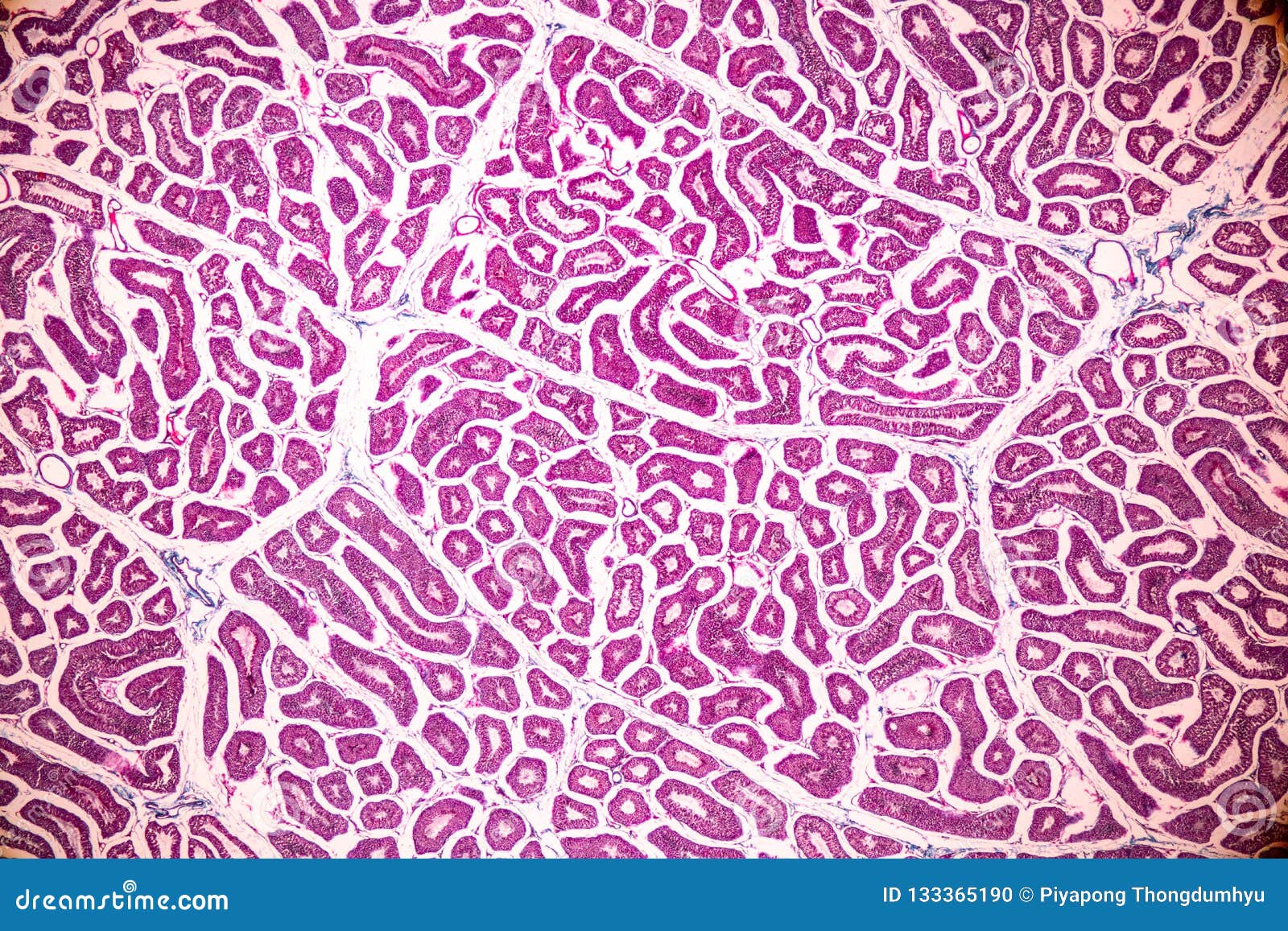 Section of Testis Tissue Under the Microscope . Stock Photo - Image of ...