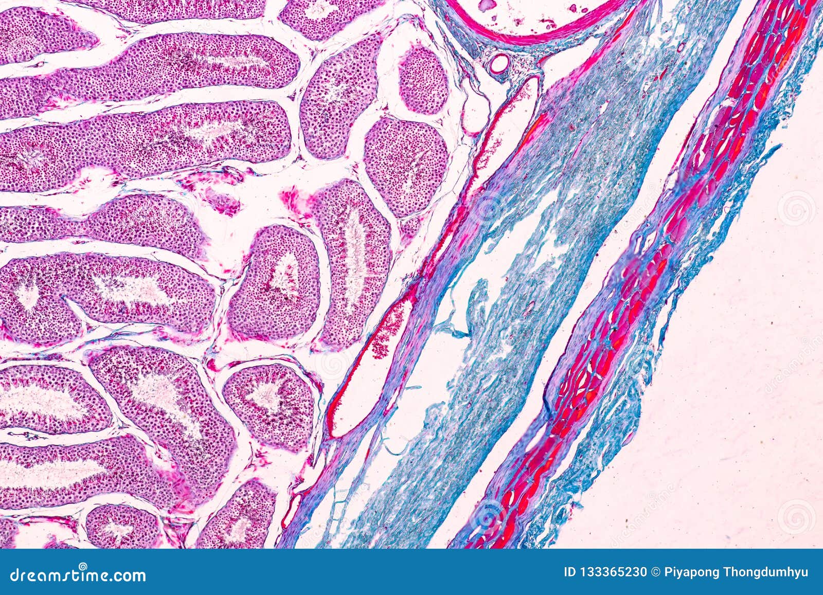 Section of Testis Tissue Under the Microscope . Stock Photo - Image of ...
