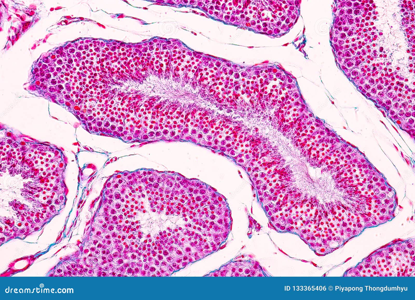 Section of Testis Tissue Under the Microscope . Stock Photo - Image of ...