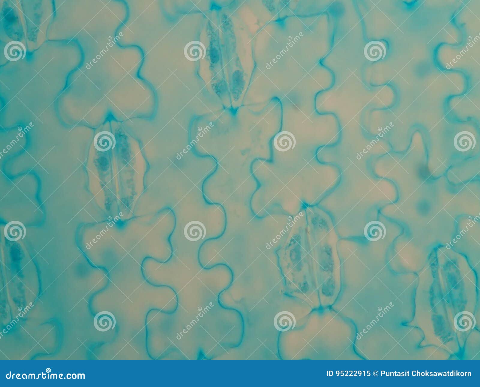 Cross Sections Of Plant Stem Under Microscope View Show Structure Of ...