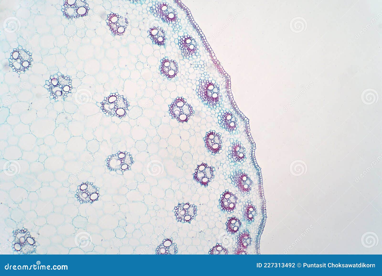 Monocot Stem Under Microscope
