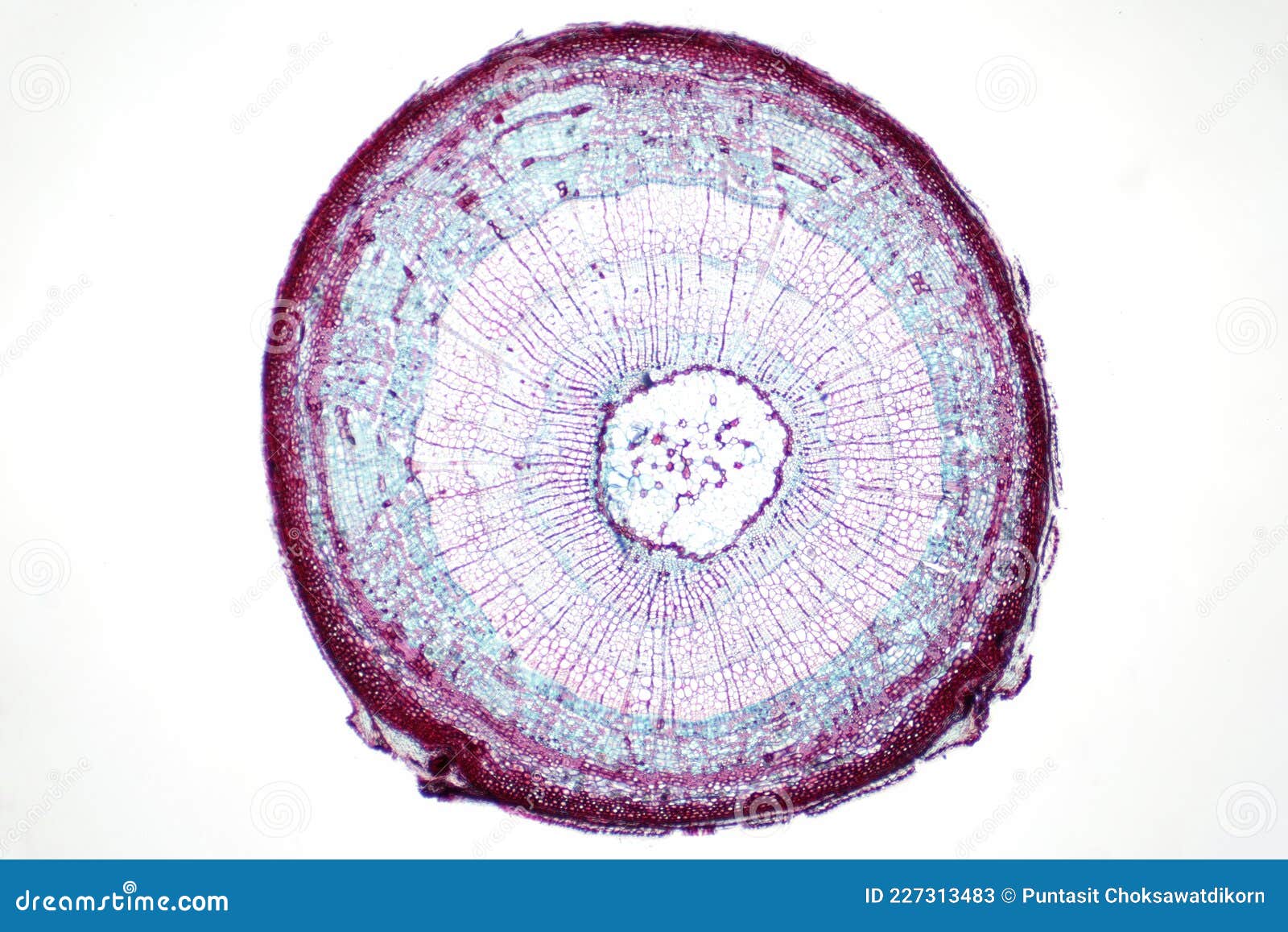 Cross Sections of Plant Stem Under Light Microscope View Stock Image ...