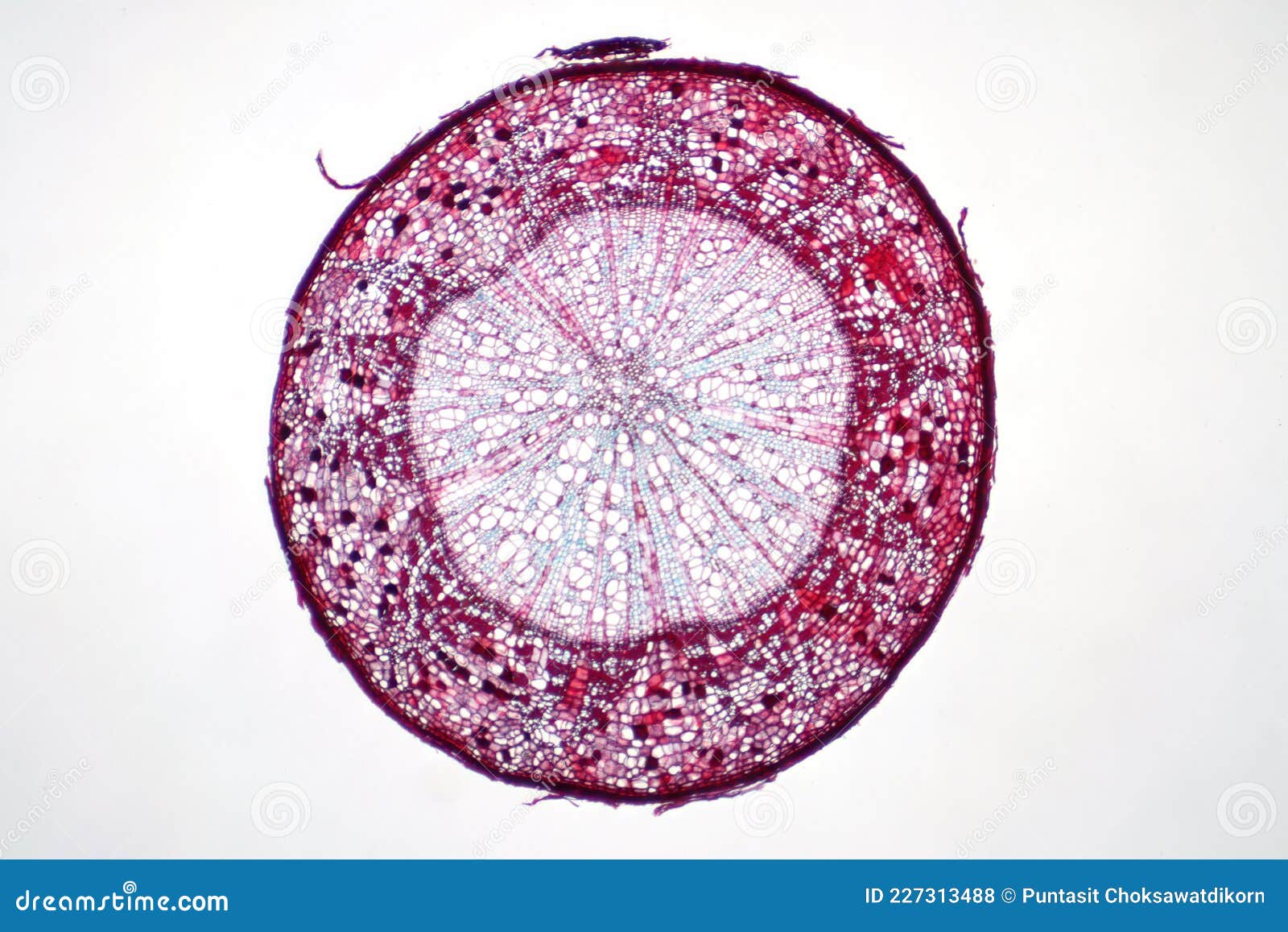 Cross Sections of Plant Stem Under Light Microscope View Stock Photo ...