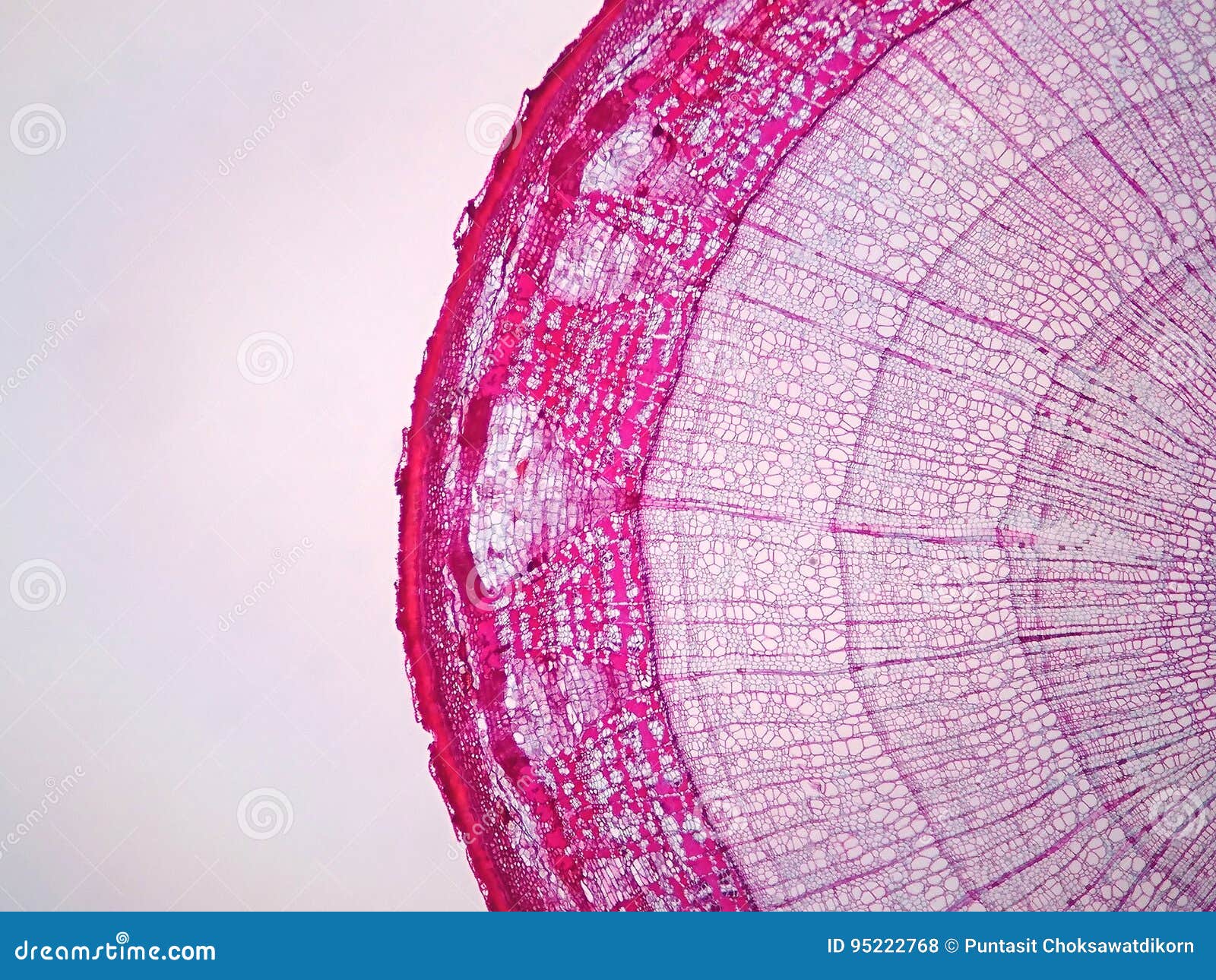 Cross Sections Of Plant Stem Under Microscope View Show Structure Of ...