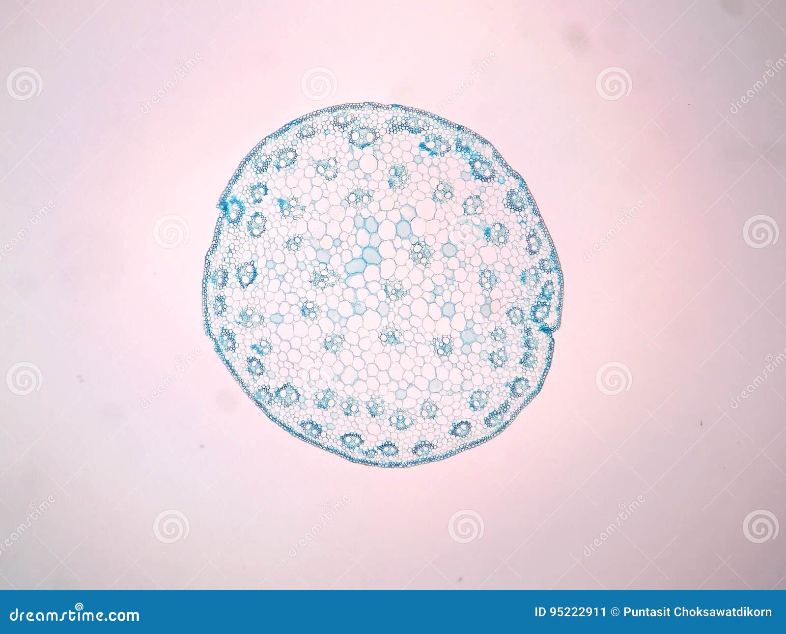 Cross Sections Of Plant Stem Under Microscope View Show Structure Of ...