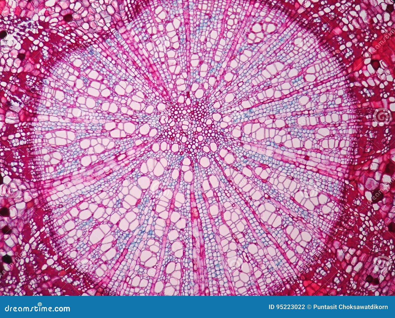 Cross Sections Of Plant Stem Under Microscope View Show Structure Of ...