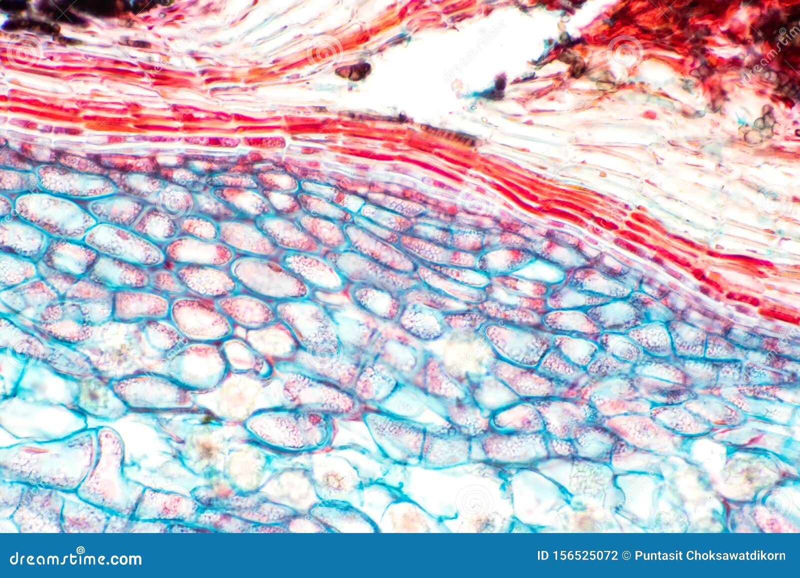 Collenchyma Cells Stem