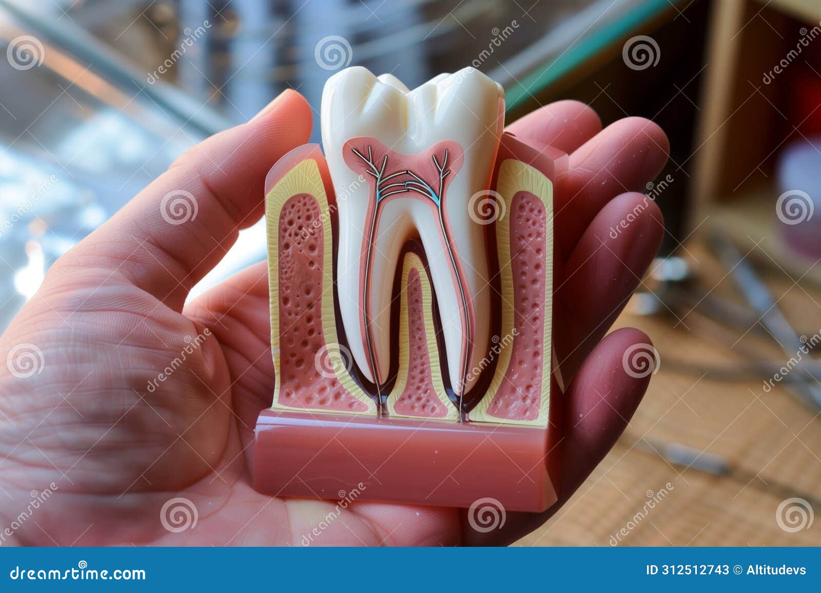 Tooth 3D Model With Plaque, Virus, Germs, Fungi, Bacteria. Stain Dirt ...