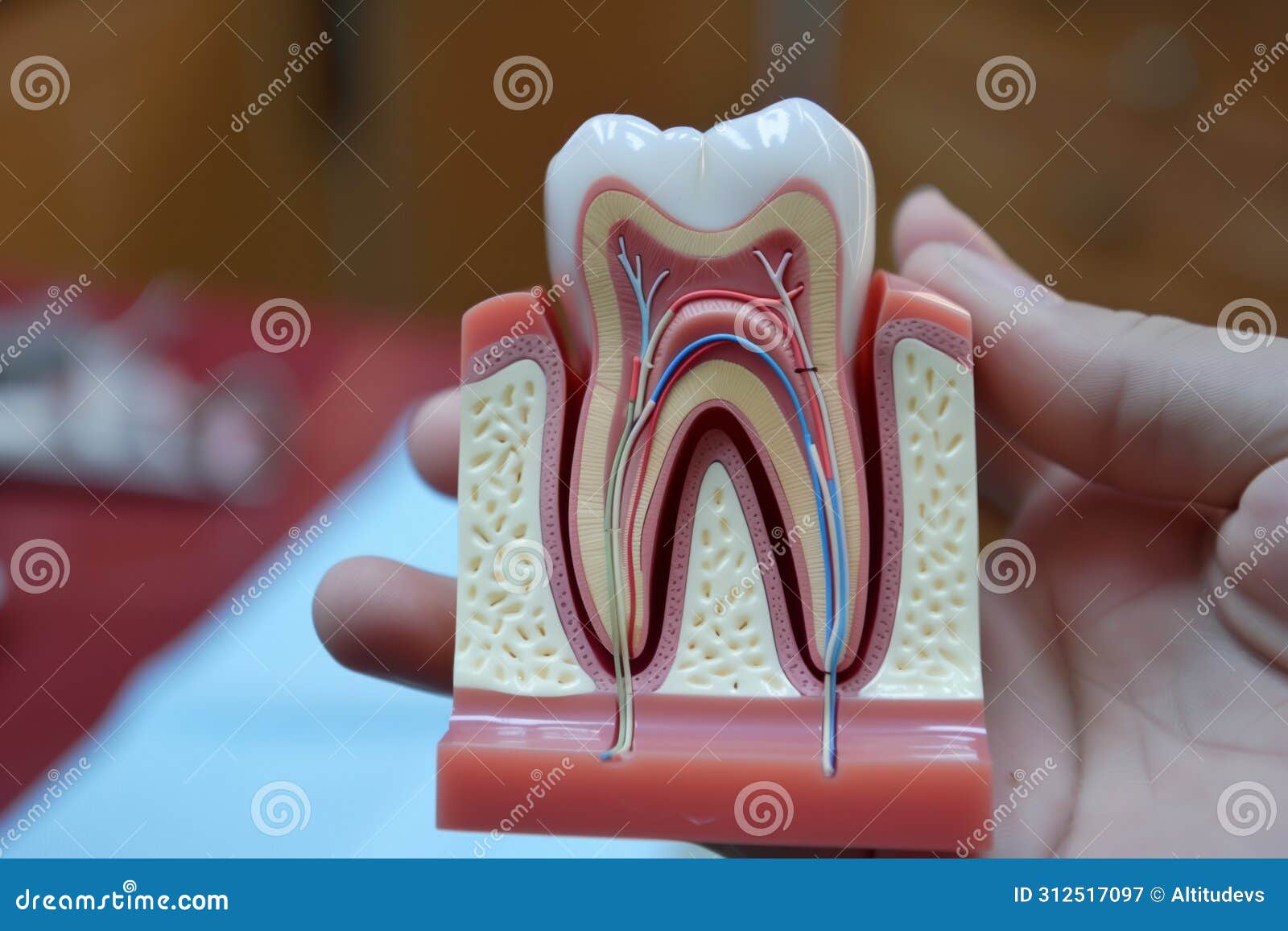 Tooth 3D Model With Plaque, Virus, Germs, Fungi, Bacteria. Stain Dirt ...