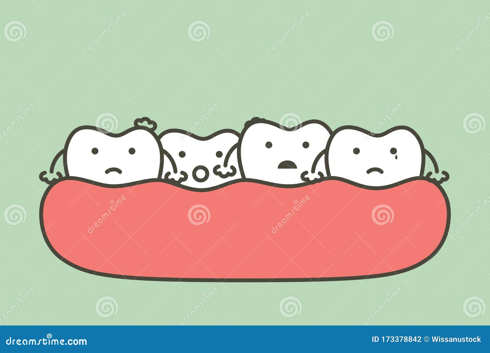 Crowding Teeth Malocclusion, Dental Problem Stock Vector - Illustration ...