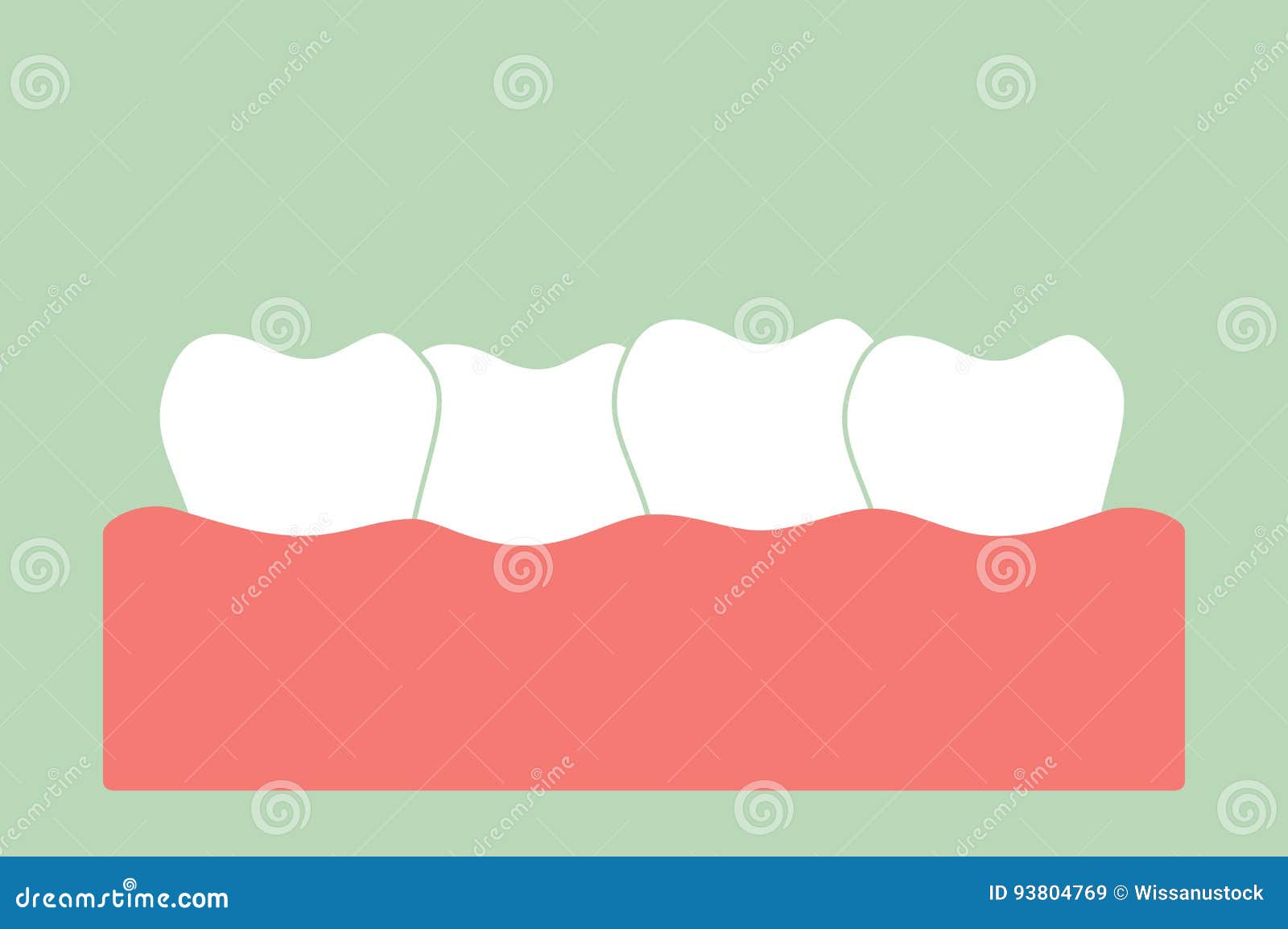 Crowding Teeth Malocclusion, Dental Problem Cartoon Vector ...