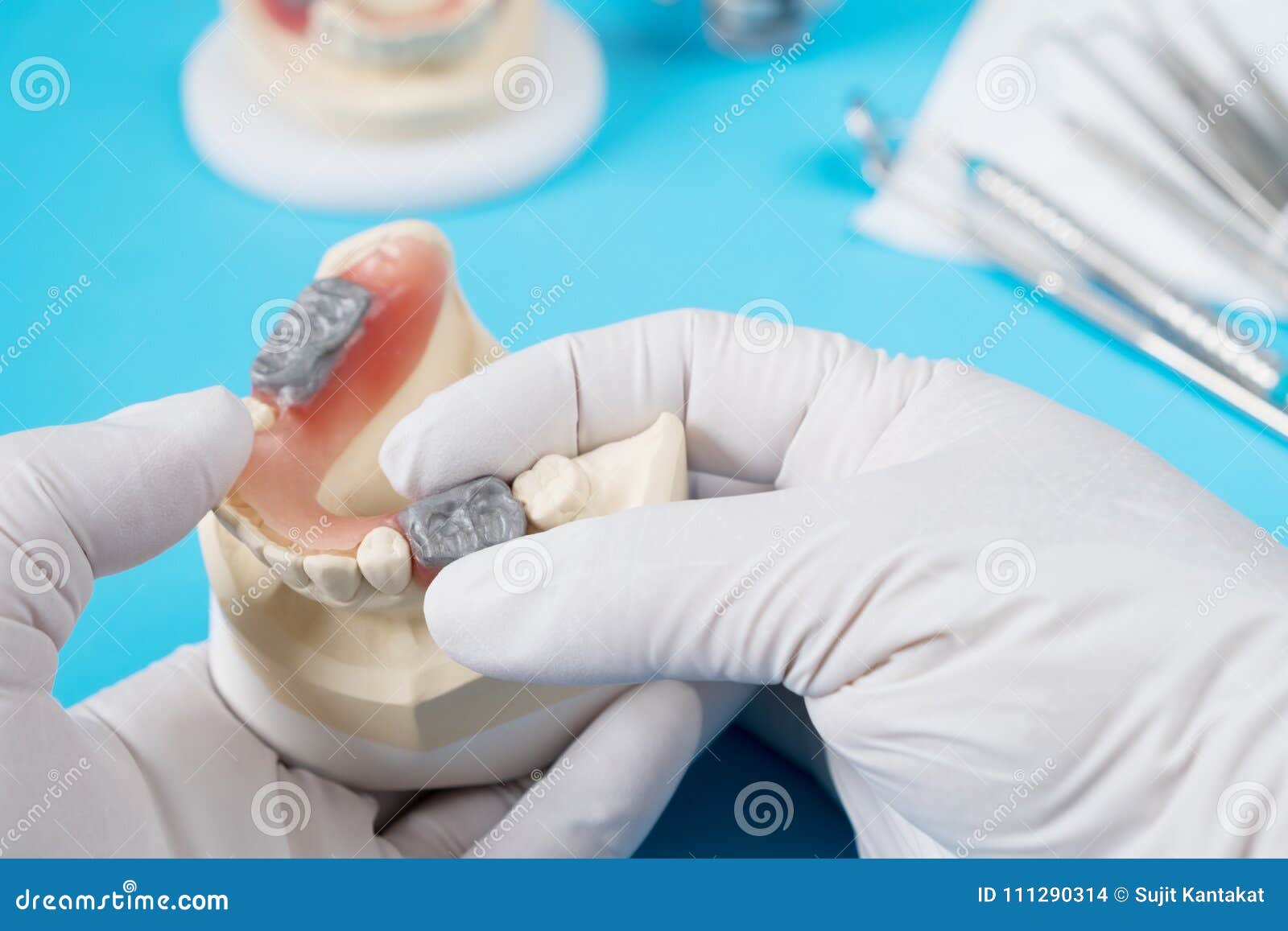 Dentist Tools and Prosthodontic Model. Stock Photo - Image of dentist ...