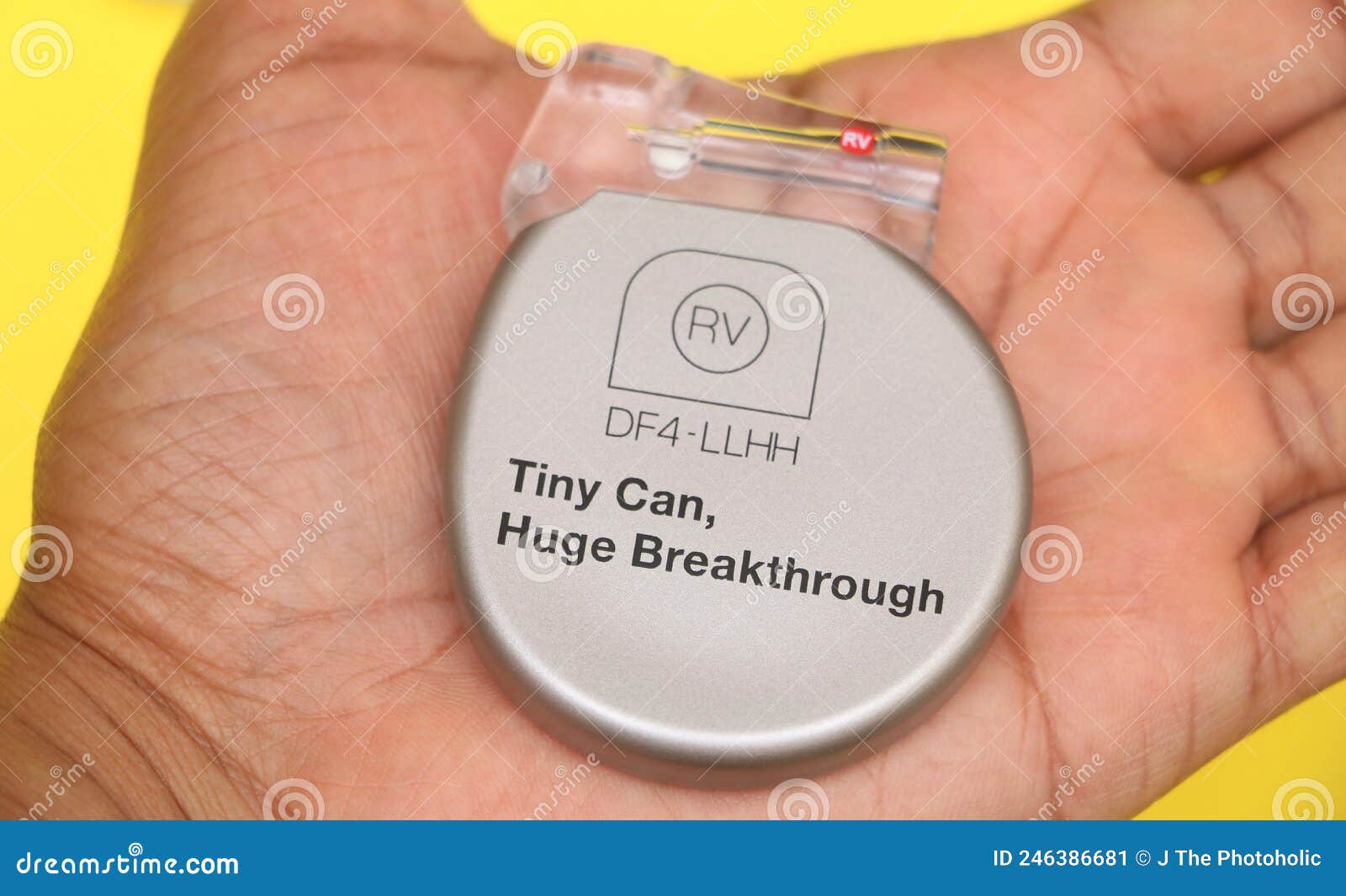 Cardiac Re-synchronization Therapy Device with Pacemaker (CRT-P) Placed ...