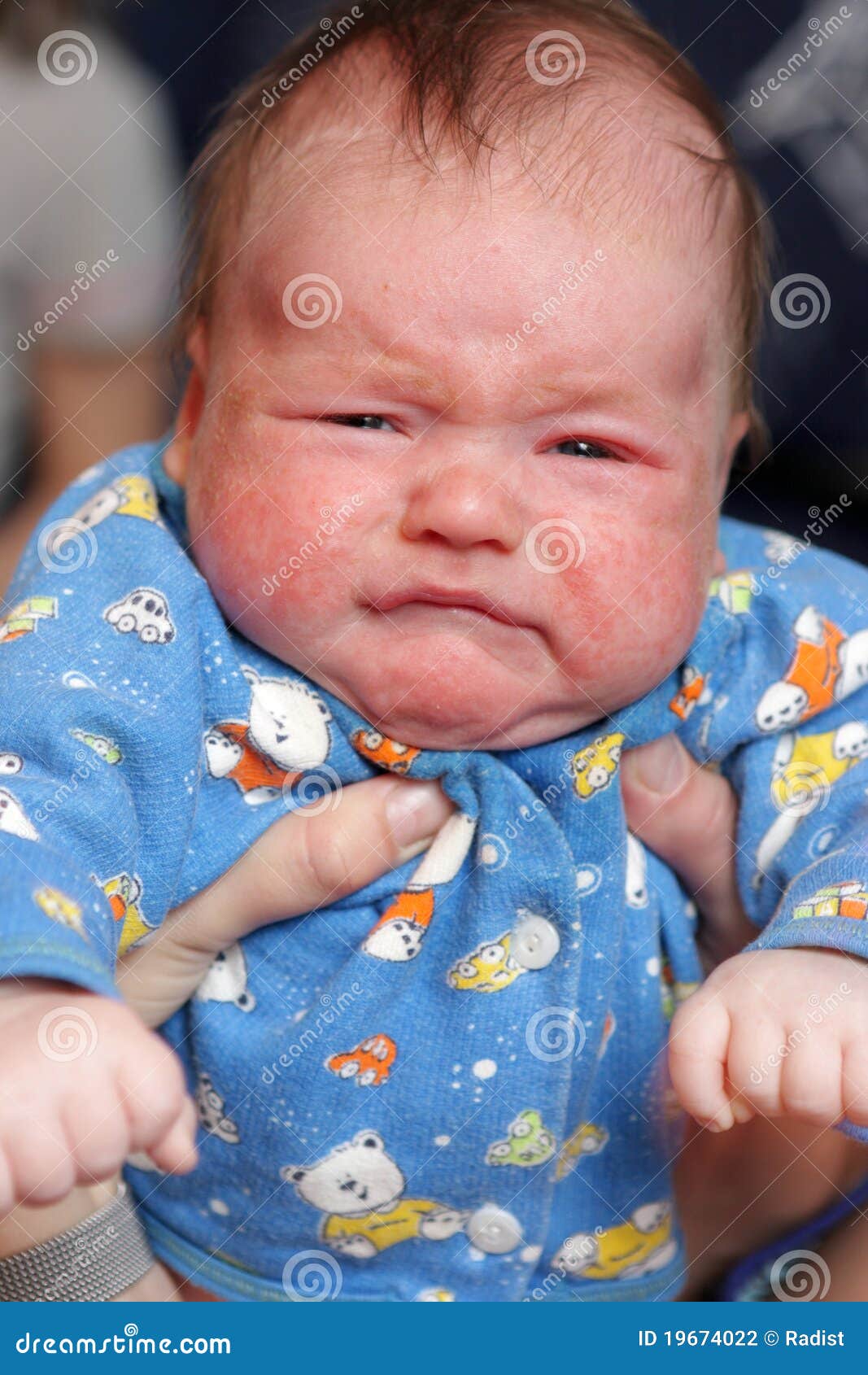 Crying Baby stock photo. Image of facial, sadness, allergic - 19674022