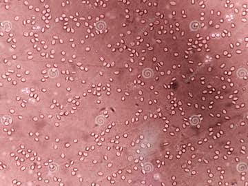 Cryptococcus Neoformans - Cerebrospinal Fluid Stock Photo - Image of ...