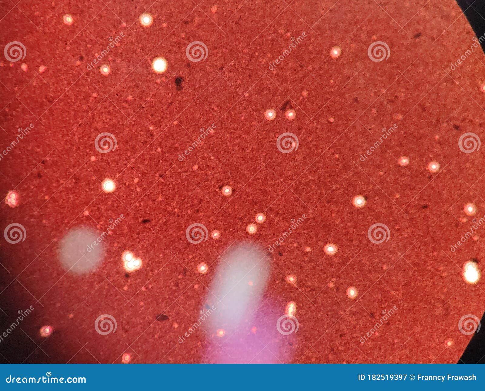 Cryptococcus Sp - Yeasts, Nanking Paint or Ink from China Stock Image ...