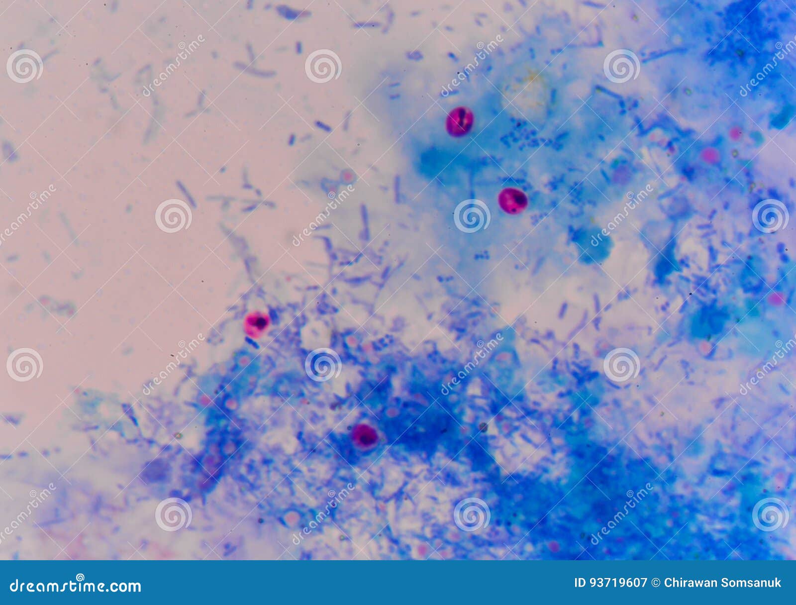Cryptosporidium Oocyte on Blue Stock Image - Image of sick, eggs: 93719607