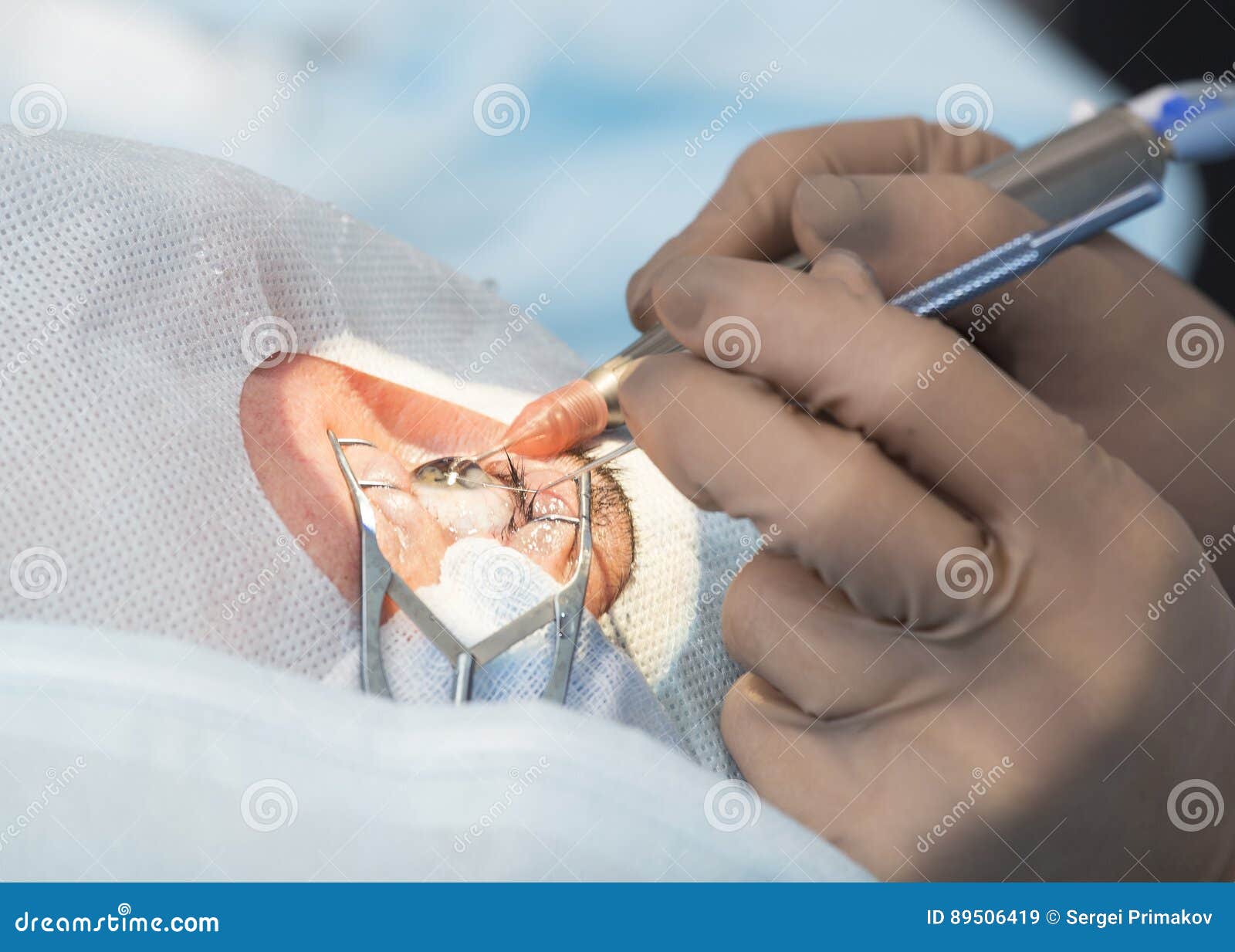 534 Surgical Method Photos - Free & Royalty-Free Stock Photos from ...