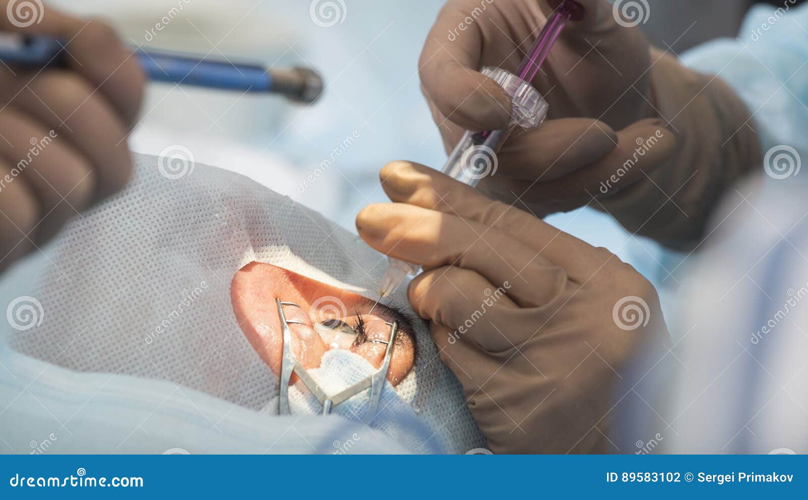 Crystalline Lens Replaceable Surgical Method Stock Photo - Image of ...