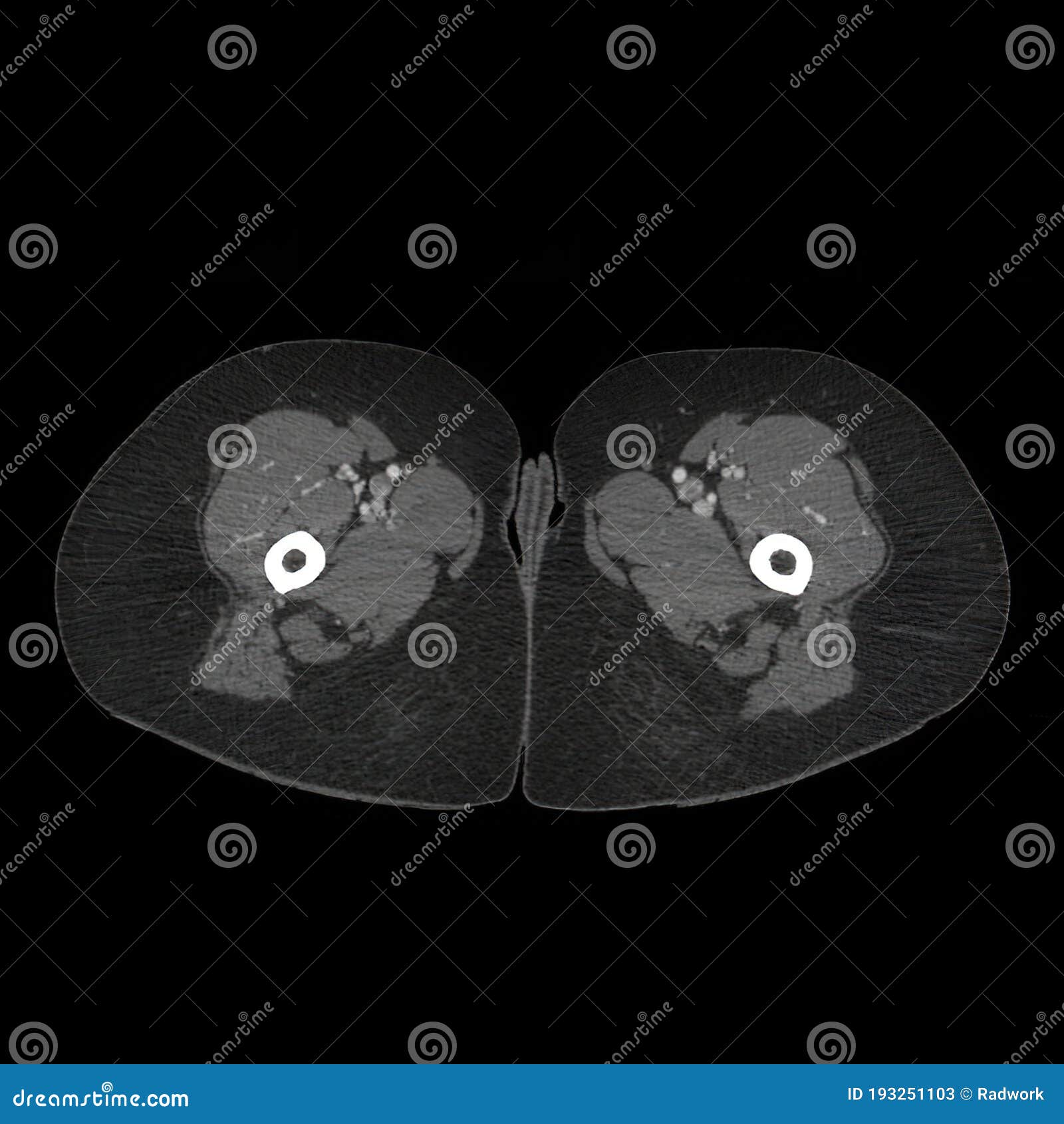 CT Axial plane stock illustration. Illustration of radiographer - 193251103