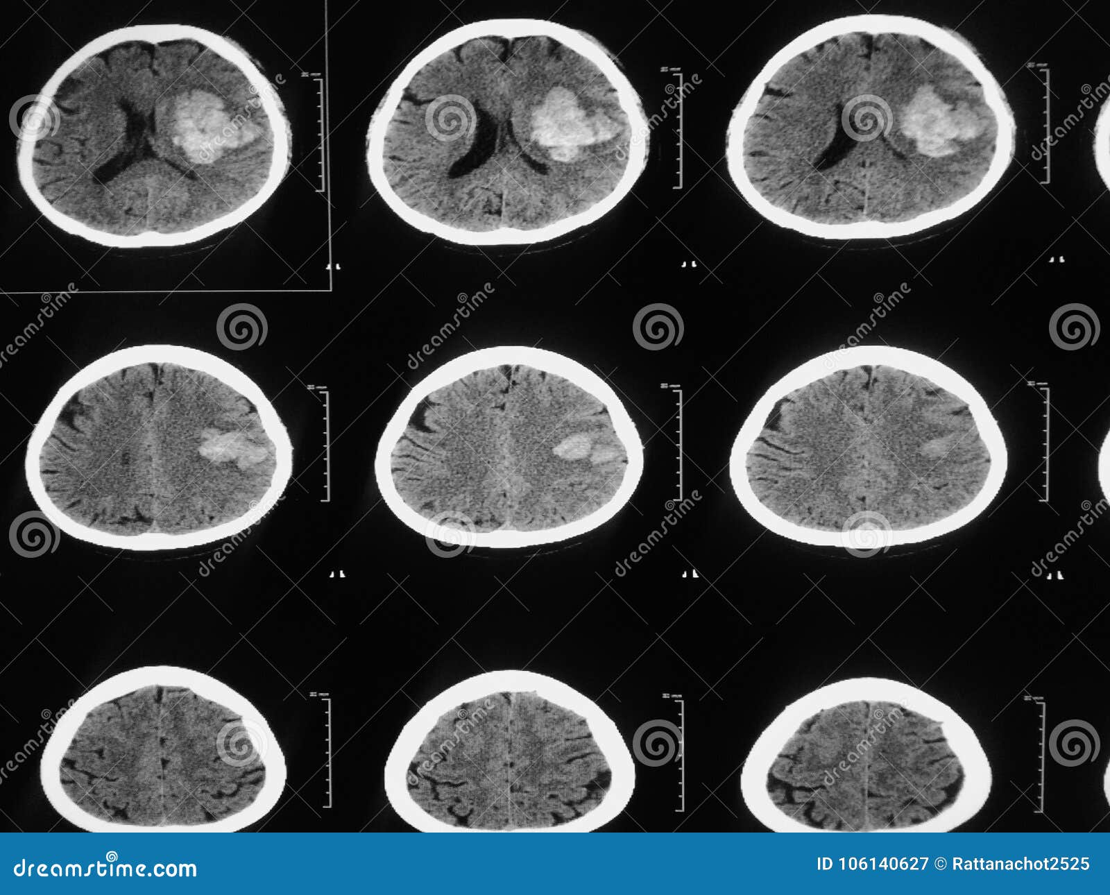 CT-Brain stock image. Image of cross, font, head, background - 106140627