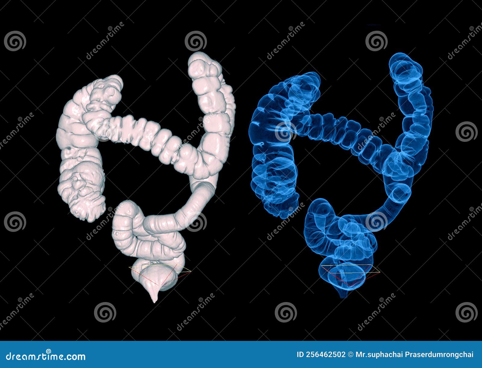 Ct Colonography 3d Rendering Stock Illustration Illustration Of