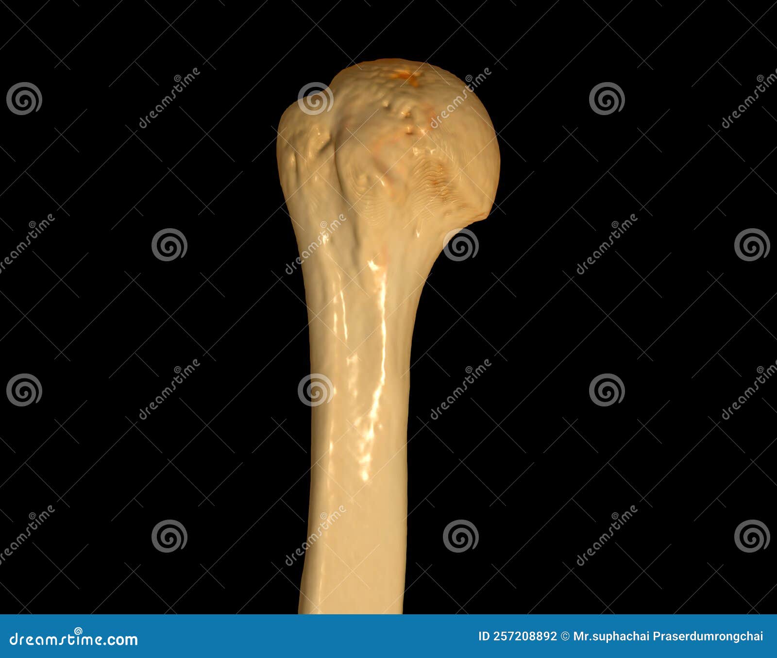 CT head of humerus 3D stock illustration. Illustration of pain - 257208892
