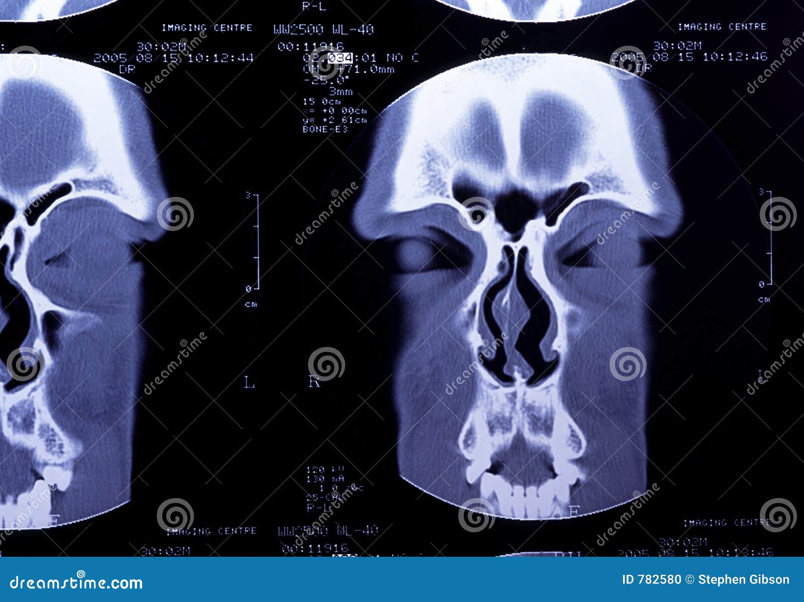 CT Head Scan Detail stock photo. Image of computer, brain - 782580