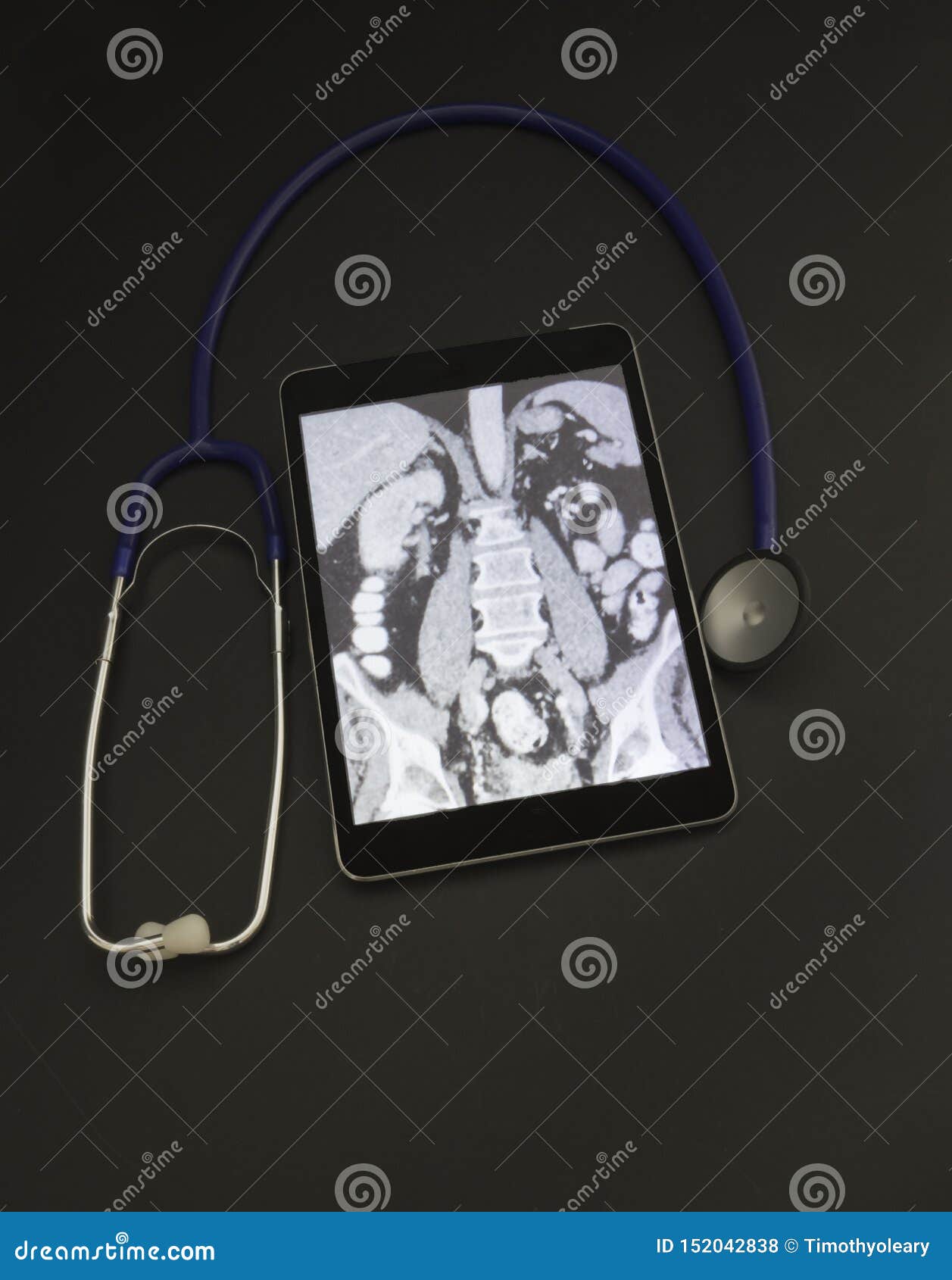 Ct Scan To Perform and Evaluate a Patient Status and Create a Diagnosis ...