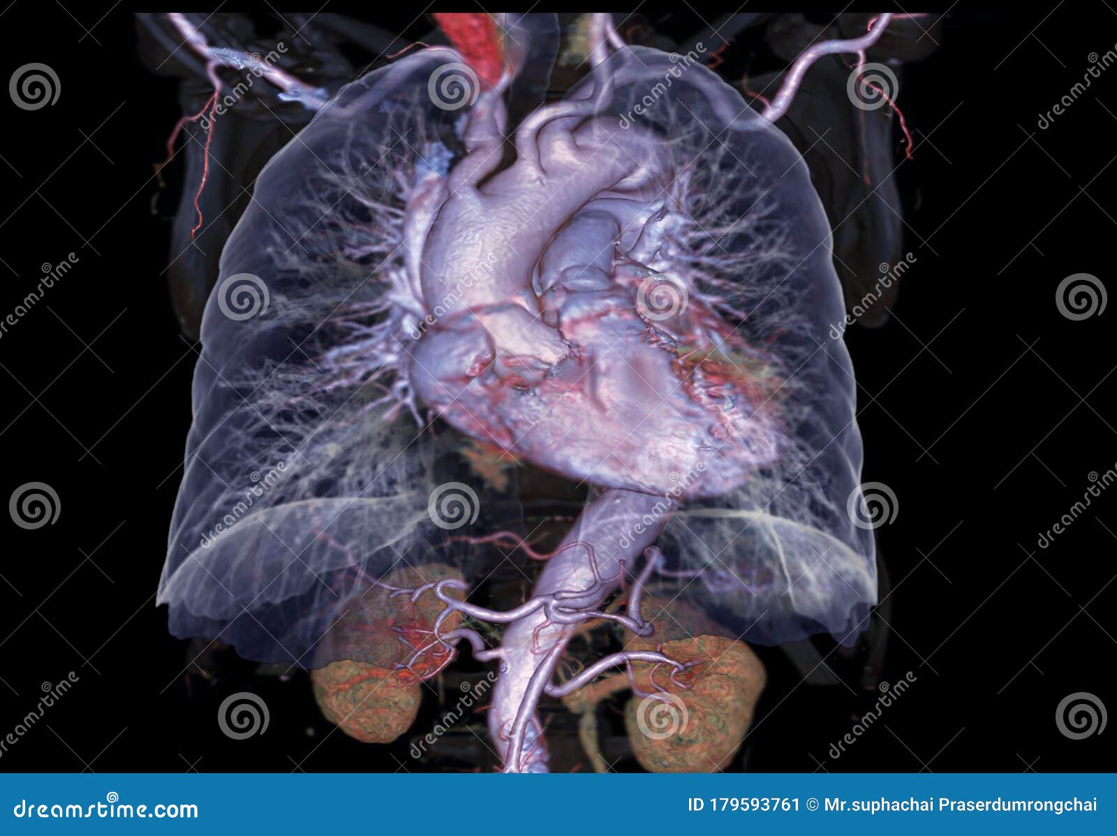 Cardiovascular, Pleural, Tuberculosis, Hospital, Life, Bronchitis ...
