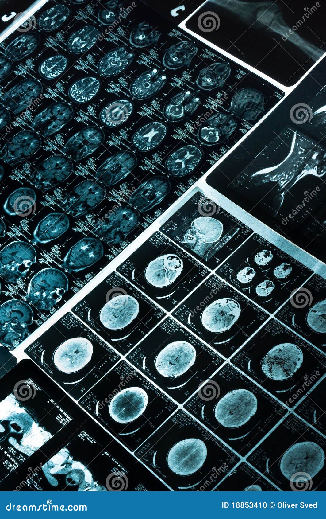 CT Scan And MRI Images Royalty-Free Stock Photo | CartoonDealer.com ...