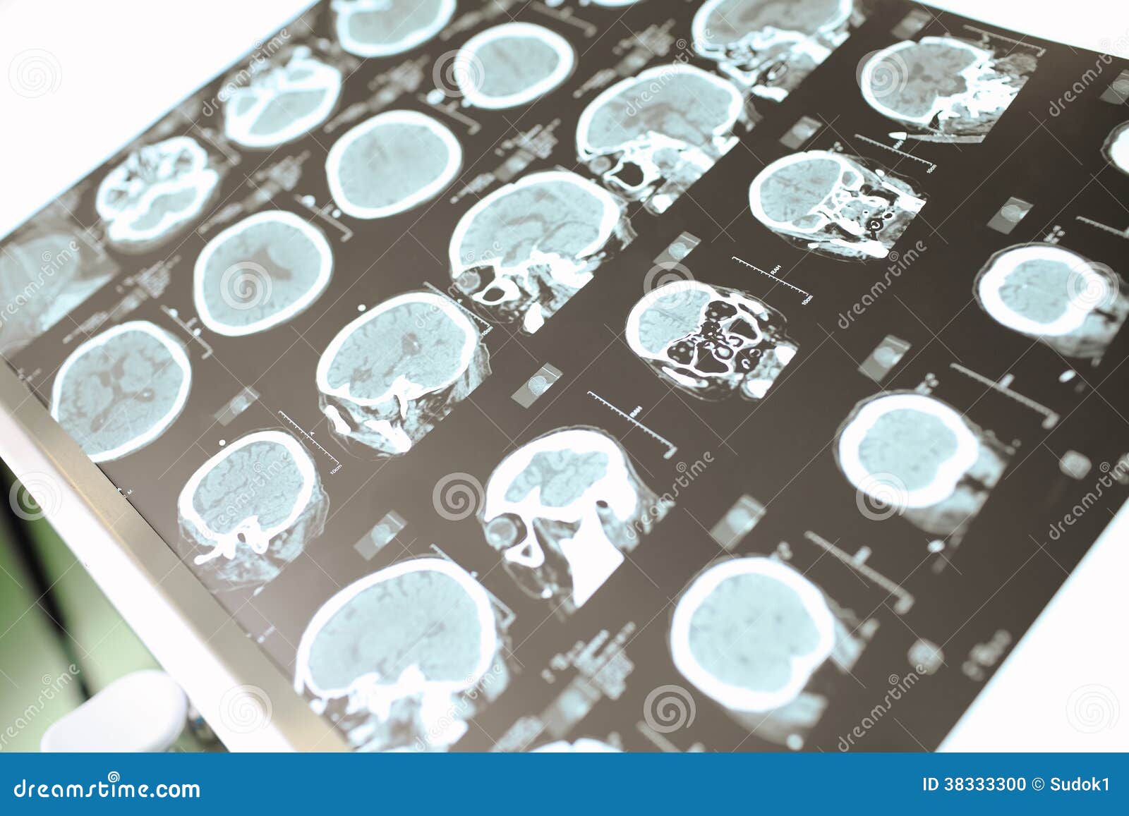 CT neurological patient stock photo. Image of ideas, exam - 38333300