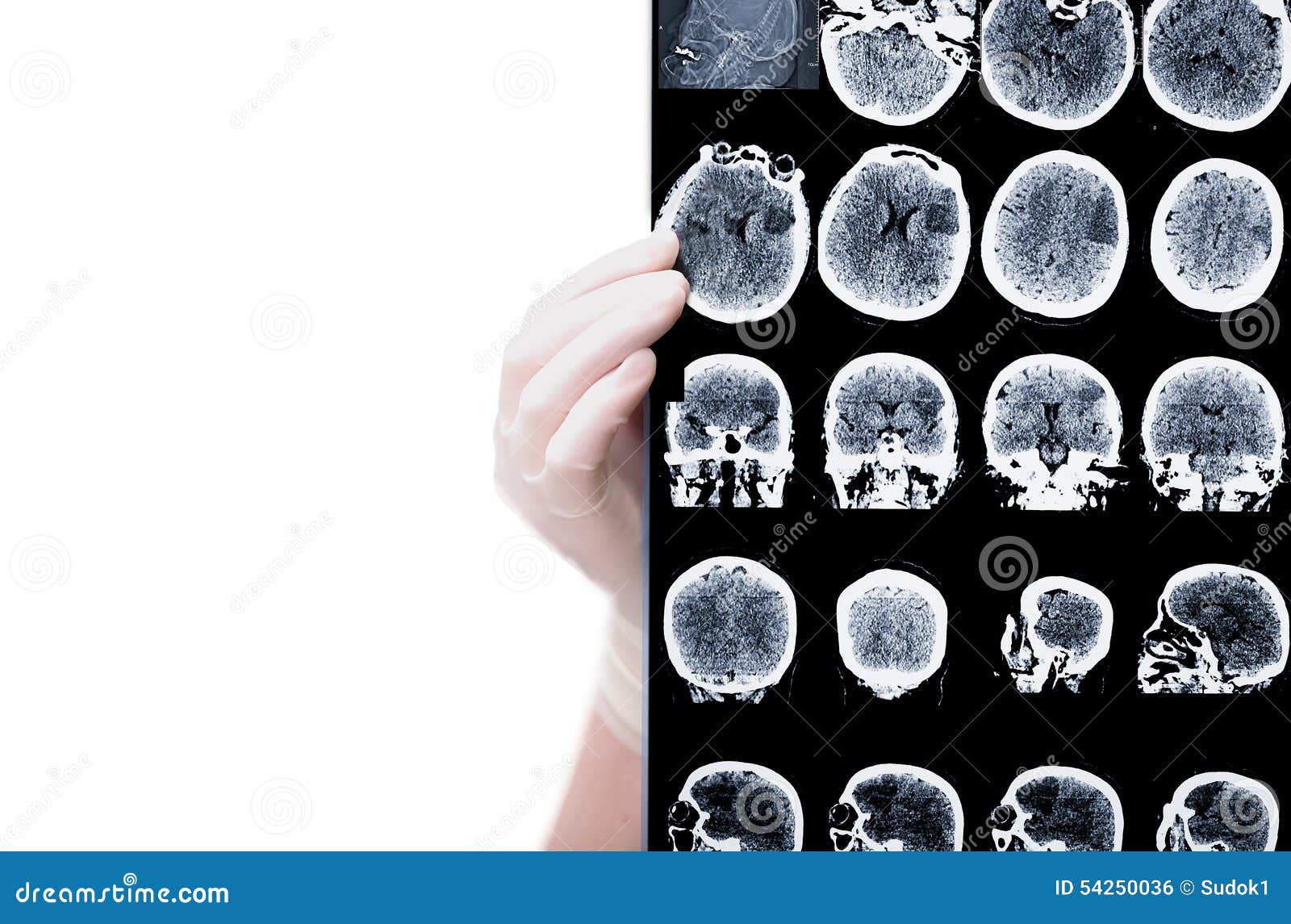 CT Picture in Doctor Hands on White Stock Photo - Image of examining ...