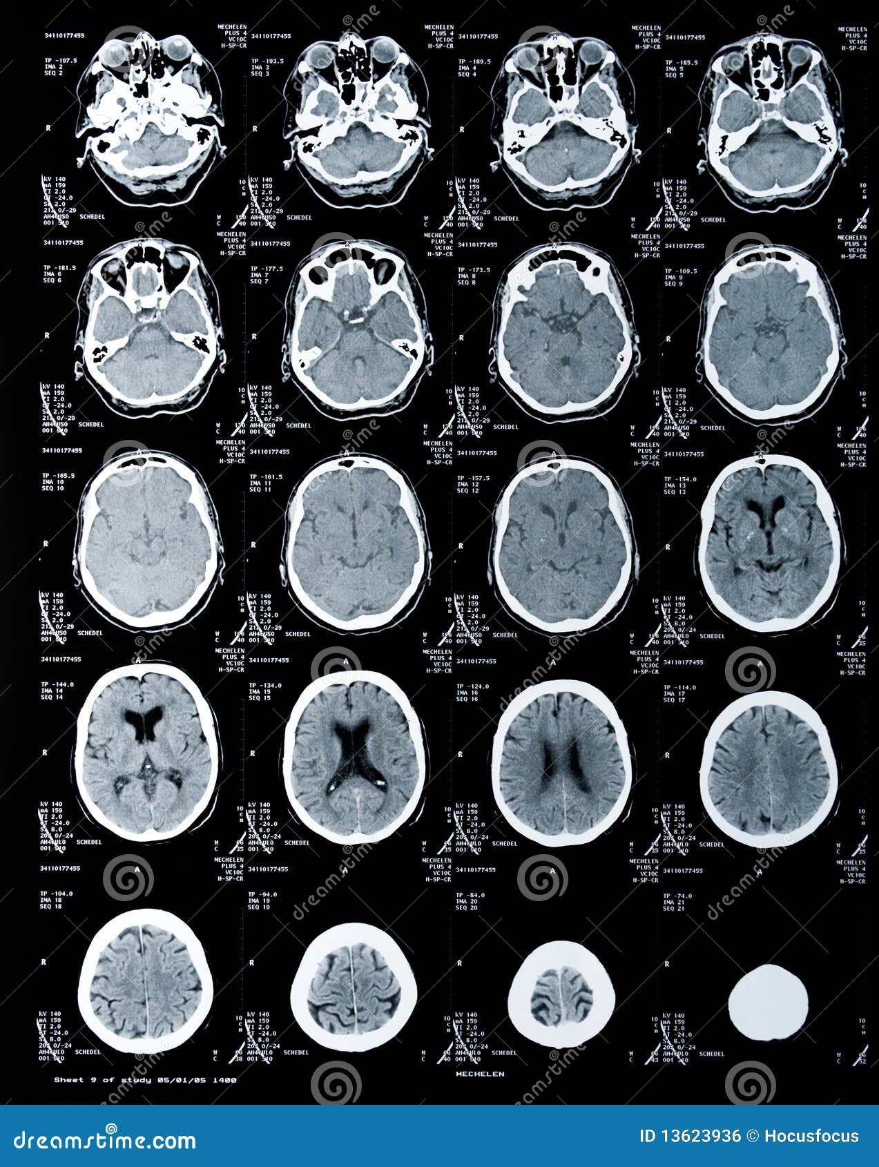 Ct scan stock photo. Image of medical, mature, research - 13623936