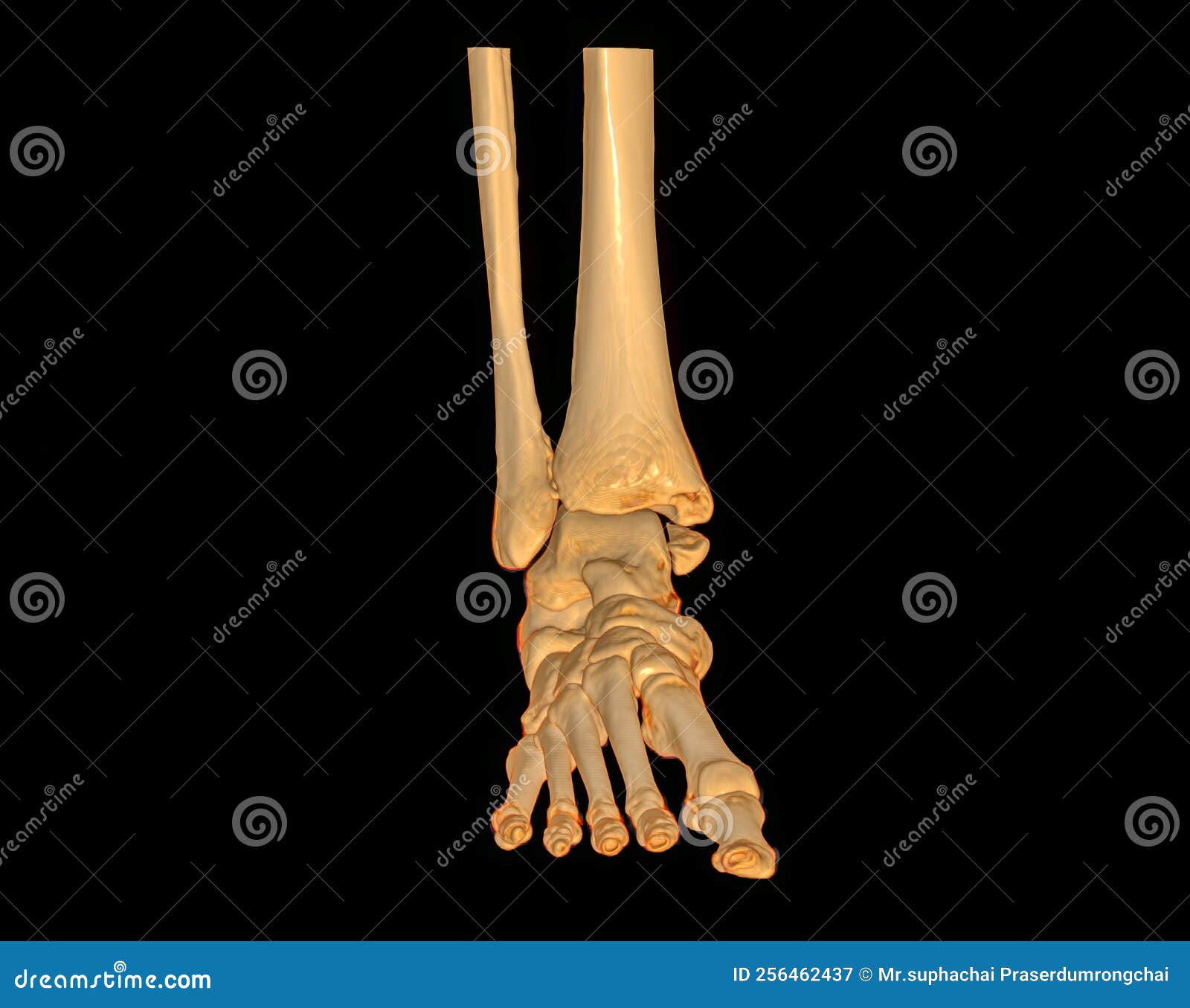CT Scan Ankle And Foot Or Computed Tomography Of Ankle Joint And Foot ... CT Scan Ankle And Foot Or Computed Tomography Of Ankle Joint And Foot ...